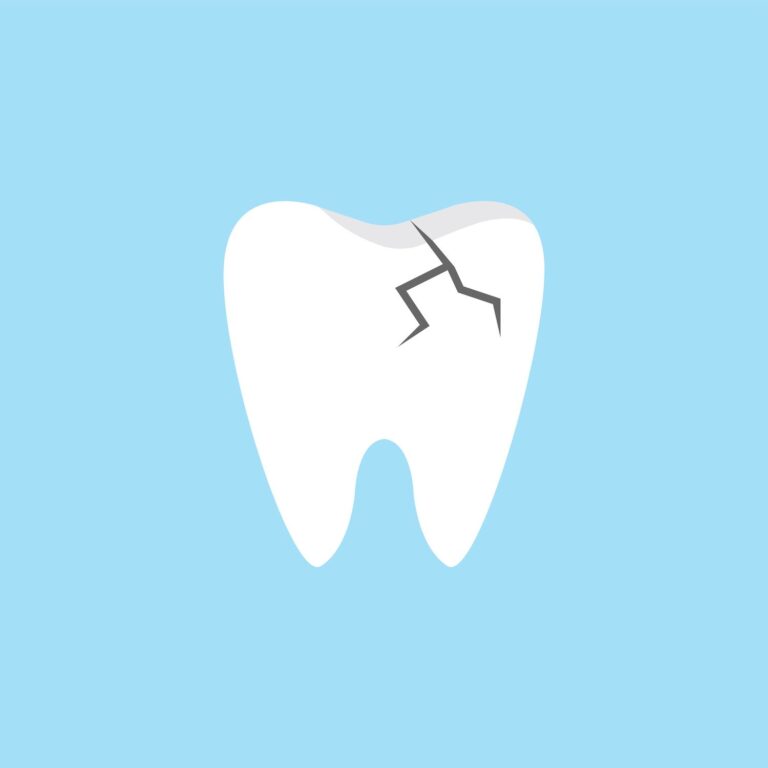 Do I Have a Tooth Fracture? - Philadelphia, PA Dental Care